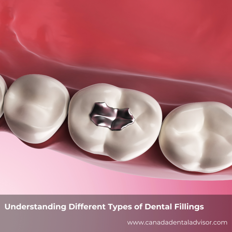 Understanding Different Types of Dental Fillings