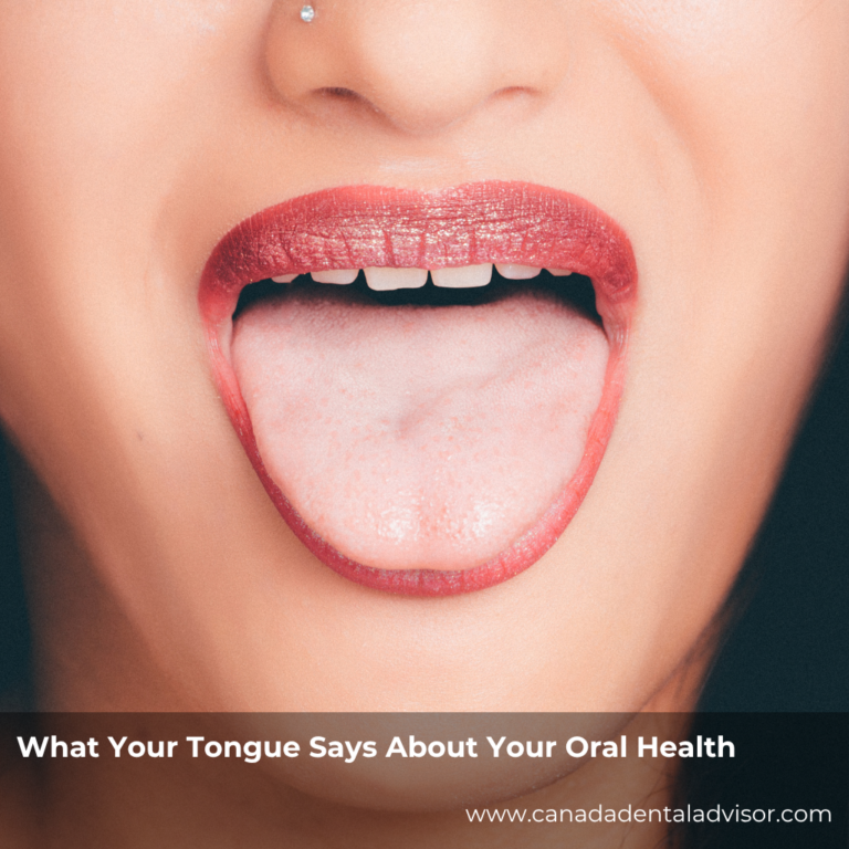 What Your Tongue Says About Your Oral Health